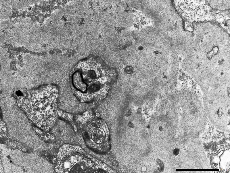 SEM/TEM/EPMA | Image Contest Grand Prize Winners | 2023